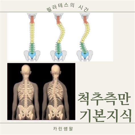 척추 측만 기본 지식 1 경기도 부천시 옥길동 필라테스 당근 비즈 소식