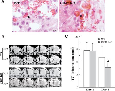 Figure 1 From Role Of Erythrocyte Cd47 In Intracerebral Hematoma Clearance Semantic Scholar