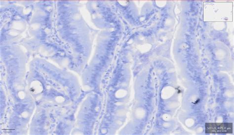 Issue With Getresultcount Image Analysis Imagesc Forum