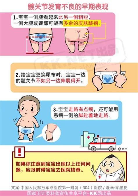 寶寶髖關節發育不良致殘率高 每日頭條
