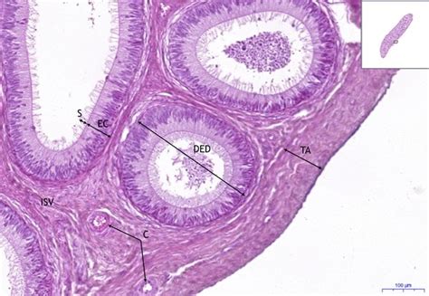 Epididymis He Wikiskripta
