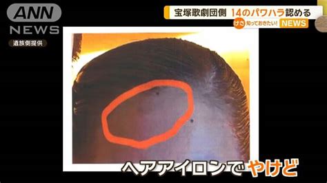 岡山県で新たに3061人感染、3人死亡 医療機関など16カ所でクラスター〈新型コロナ〉 Ksbニュース Ksb瀬戸内海放送