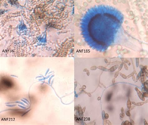 Microscopic View After Lactophenol Cotton Blue Staining Download