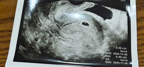 임신 5주차 아기집 혈액검사 및 초음파 확인 후기 네이버 블로그