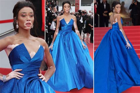 Winnie Harlow Flaunts Her Incredible Figure In Nothing But A Thong As