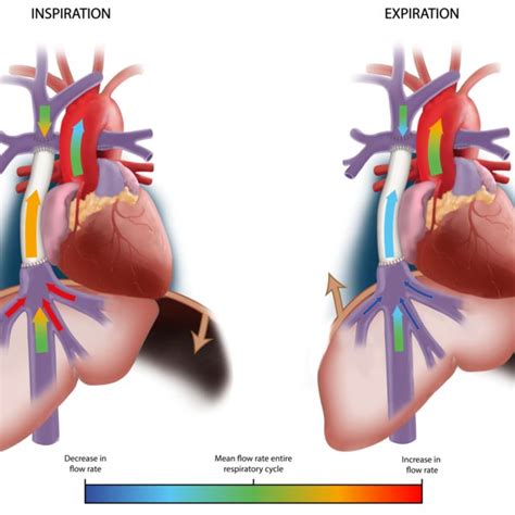 A Schematic Representation Of The Tcpc Is Shown In This Example An Download Scientific