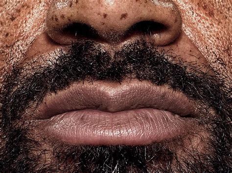 Brown Spots On Lips And Gums Meanings
