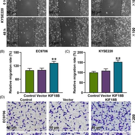 The Effect Of Kif18b Overexpression On Escc Cell Migration And
