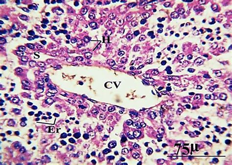 Shows Arepeated Appearance Of Megakaryocytes Black Arrow And