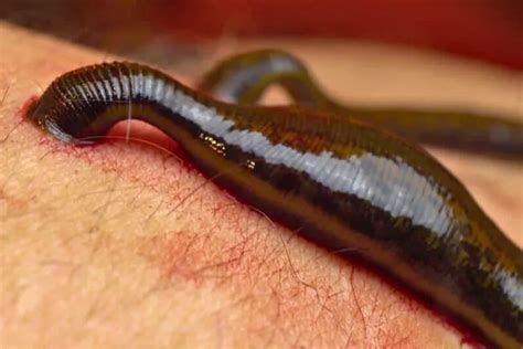 Are Leeches Edible My Honest Take