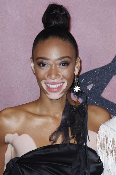 Winnie Harlow Model Interview Red Nose Day Ambassador British Vogue British Vogue