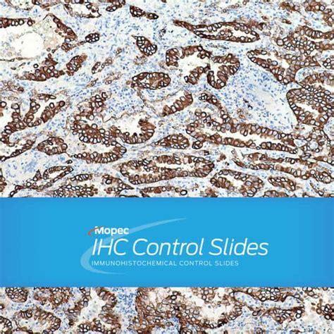 Control Slides Mopec