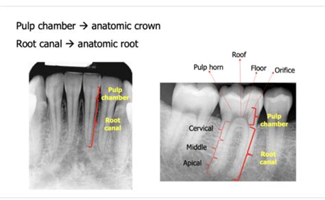 Anterior Tooth Root Morphology Flashcards Quizlet
