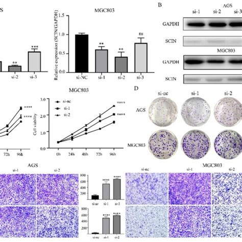 Down Regulation Of Scin Promotes Gc Cells Proliferation Migration And