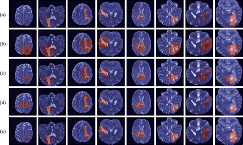 Global Weighted Average Pooling Network With Multilevel Feature Fusion For Weakly Supervised