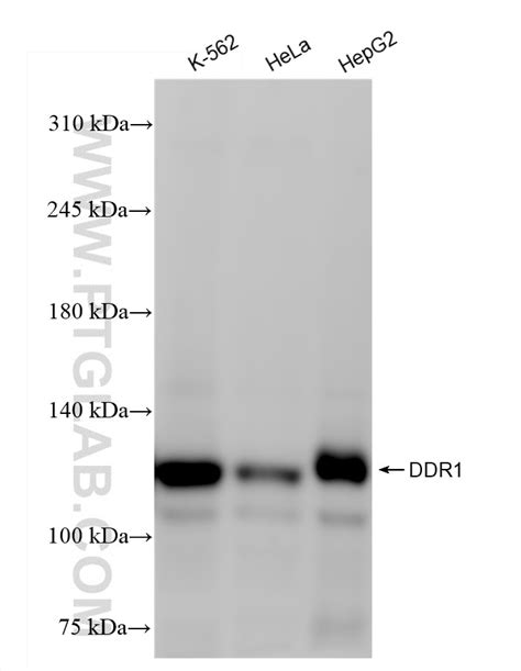 Ddr1cd167a Antibody 84438 6 Rr Proteintech