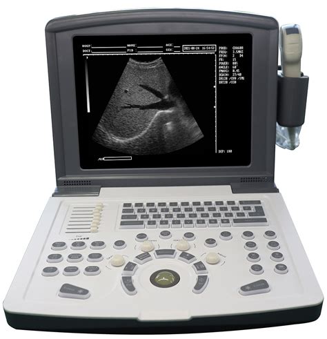 Portable Usg Echographie Portable Ultrasound Machine China Portable