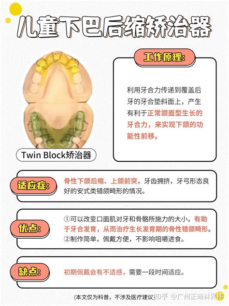 儿童下巴后缩选哪个矫治器更好上 知乎