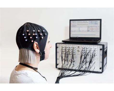 Functional Near Infrared Spectroscopy Market Regional Trade
