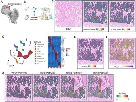 Mapping The Spatial Atlas Of The Human Bone Tissue Integrating Spatial