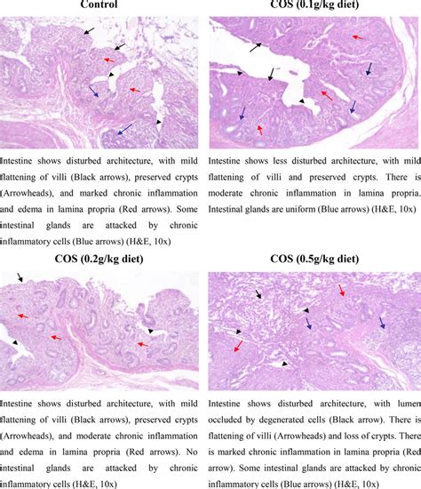 Histological Evolution Of Small Intestine Ileum After 16 Wk From
