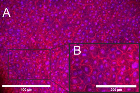 Endothelialization Of A Porcine Vascular Scaffold In A Bioreactor Download Scientific Diagram