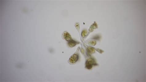 Rotifera The Microscopic Life Of Shetland Lochs
