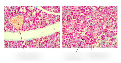 Lab Final Diagram Quizlet Lab Final Diagram Quizlet