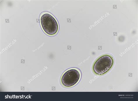 92 Imagens De Toxocara Canis Imagens Fotos Stock E Vetores Shutterstock