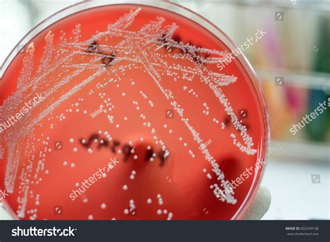 Staphylococcus Species Staphylococcus Aureus Colonies White Foto Stok 603299138 Shutterstock