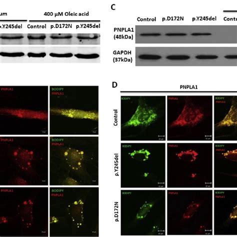Expression And Subcellular Localization Of Wild Type And Mutant Pnpla1