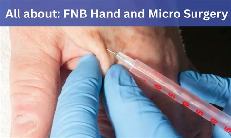 Fnb Hand And Micro Surgery Admissions Medical Colleges Fees