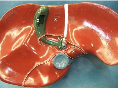 Liver Interior Diagram Quizlet