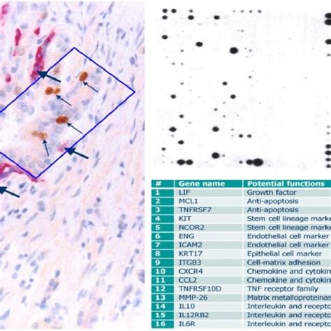 Gene Expression Profiling Of Cells Overlying Focally Disrupted And
