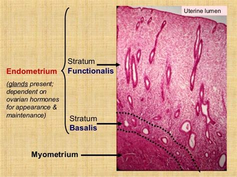Stratum Basalis Of Endometrium Here Is The Endometrial Cancer