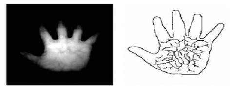 Extracting A Palm Vein Pattern 4 Download Scientific Diagram