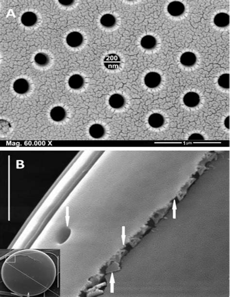 Sem Micrographs Of Actinocyclus Cf Octonarius Illustrate The Two