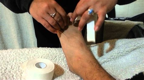 Toe Wrapping Techique YouTube
