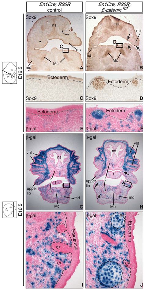 Ectopic Cartilage Formation In The Face Of Wnt Signaling Catenin