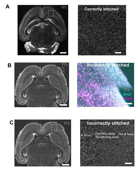 Whole Brain Single Cell Imaging And Analysis Of Intact Neonatal Mouse