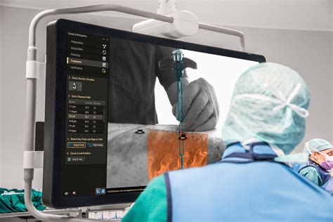 Philips Announces New Augmented Reality Surgical Navigation Technology Designed For Image Guided