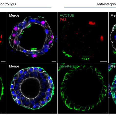 Integrin β1 Mediates Epithelial Polarity Of The Airway Organoids