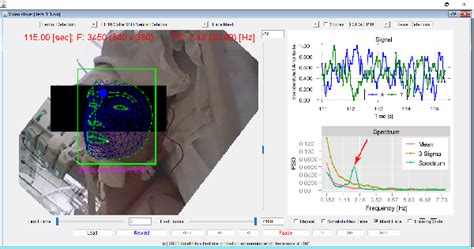 Figure 2 From Development Of Software Tools For Biomedical Signal Analysis Based On The Actor