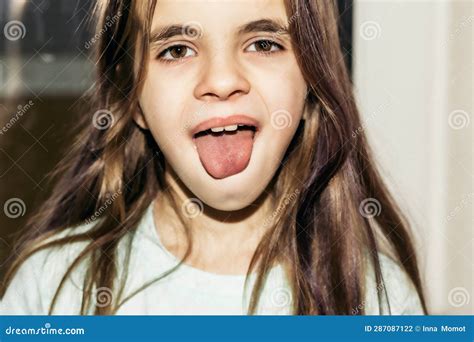 The Girl Is Brown Haired Has A Cold Shows The Doctor Tongue And