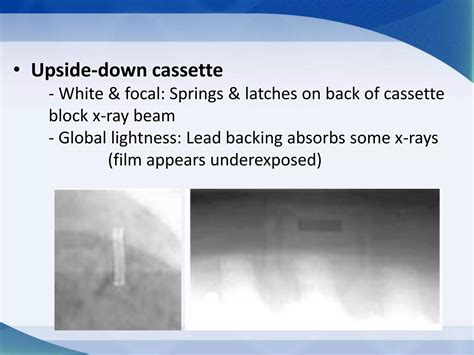Radiographic Artifacts Pptx