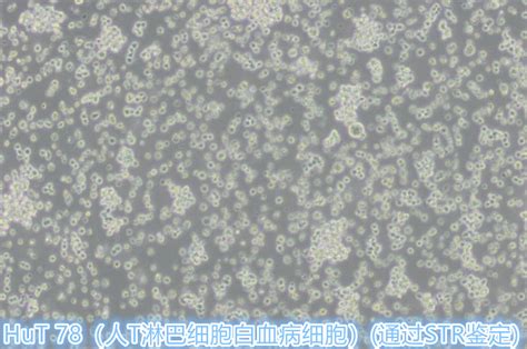HuT 78 HuT 78细胞 HuT 78人T淋巴细胞白血病细胞价格 详情介绍 960化工网 960化工网