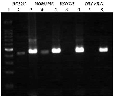 Rassf1a Promotes Apoptosis And Suppresses The Proliferation Of Ovarian