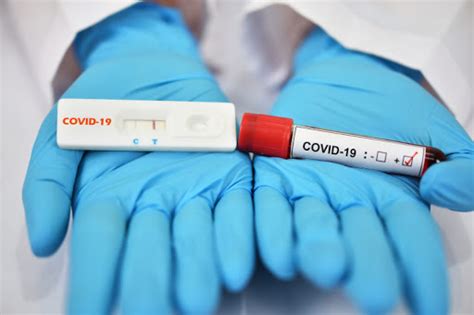 Alcances De Las Pruebas Serológicas En Covid 19 Rápidas Cualitativa