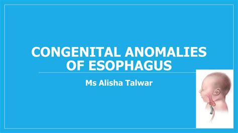 Congenital Anomalies Of Esophagus PPT