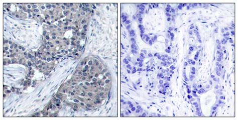Eif4ephospho Ser209 Antibody Sab Signalway Antibody